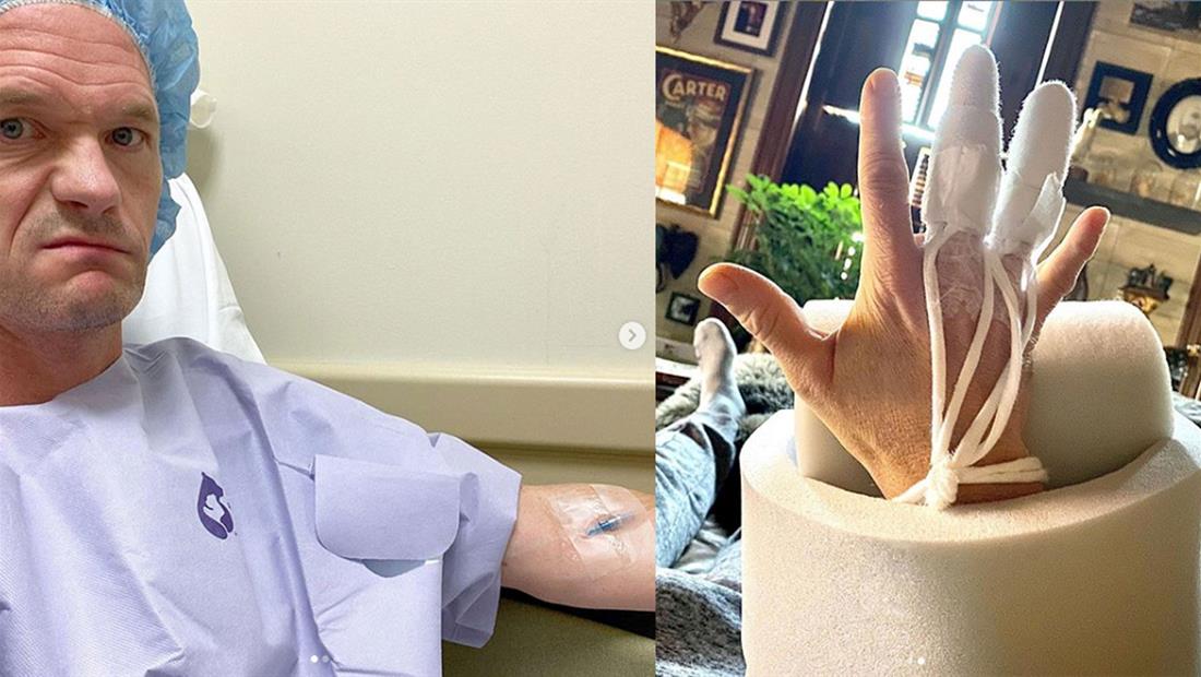 Neil Patrick Harris Recovering From Hand Surgery After This Bizarre ...