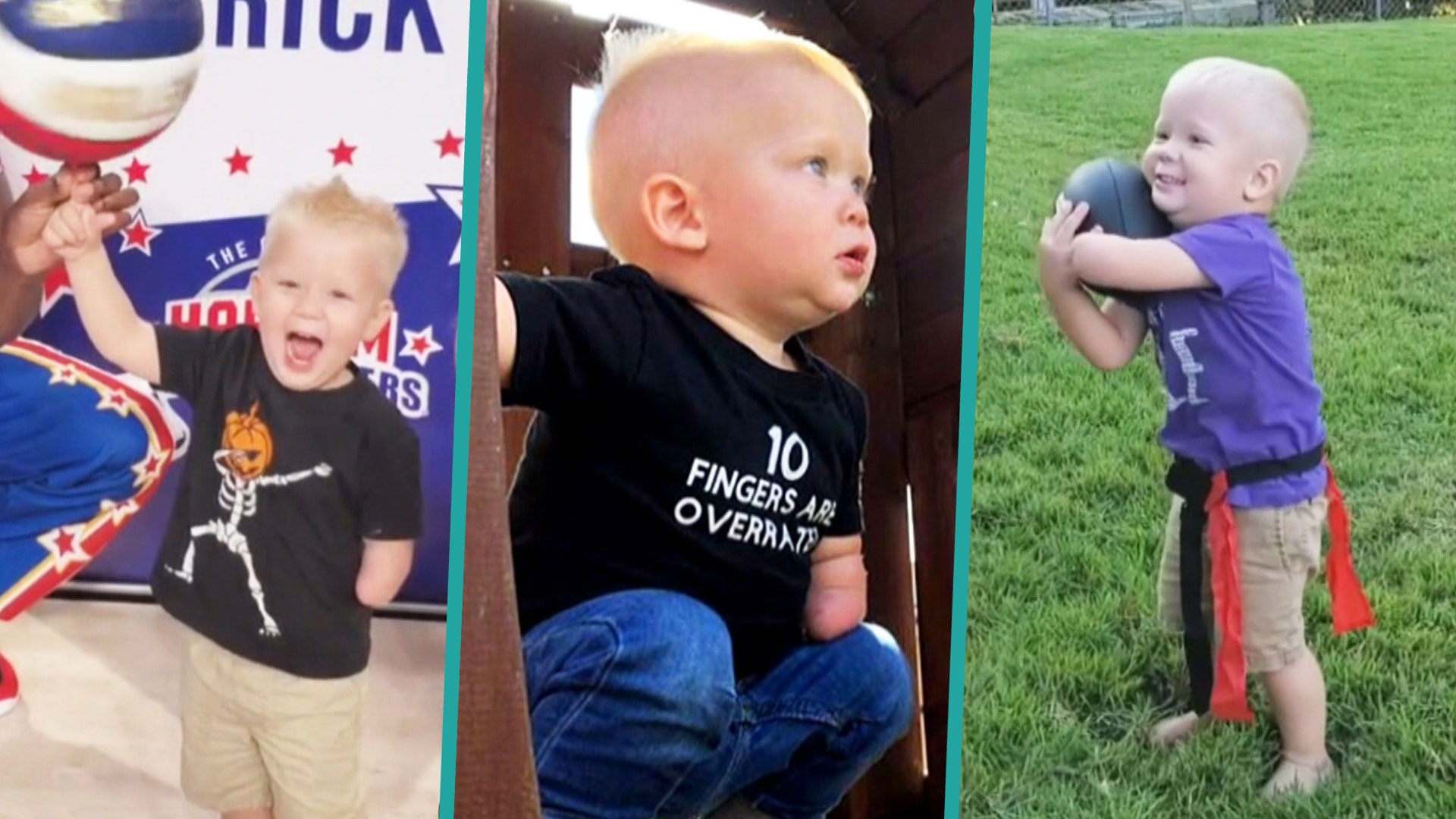 Toddler Born Without Hand Proves Nothing Is Impossible: Inside His ...